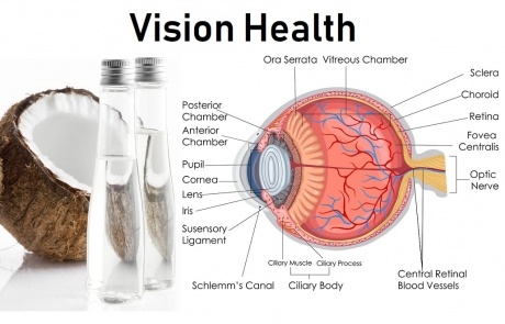 Study: Coconut Oil Prevents Macular Degeneration – Healthy for the Eyes ...